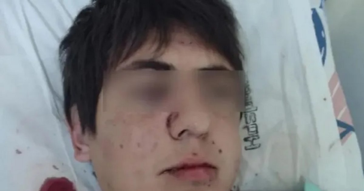 Corrientes Un Joven Está Internado Tras Una Feroz Golpiza A La Salida 7014