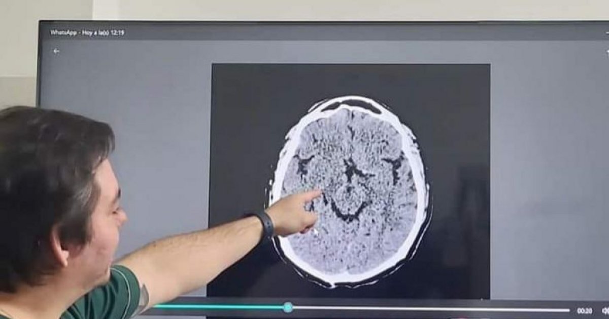 Hospital de Goya: realizaron con éxito la primera trombolisis a un ...